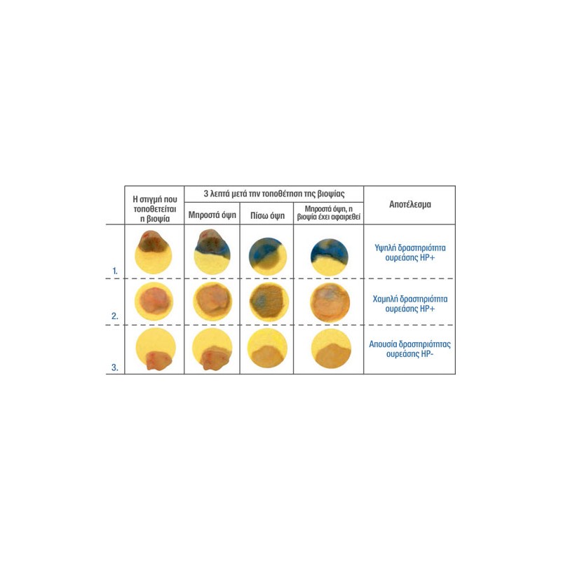 AMA RUT CLO Hpylori in biopsy specimens 24 test/kit